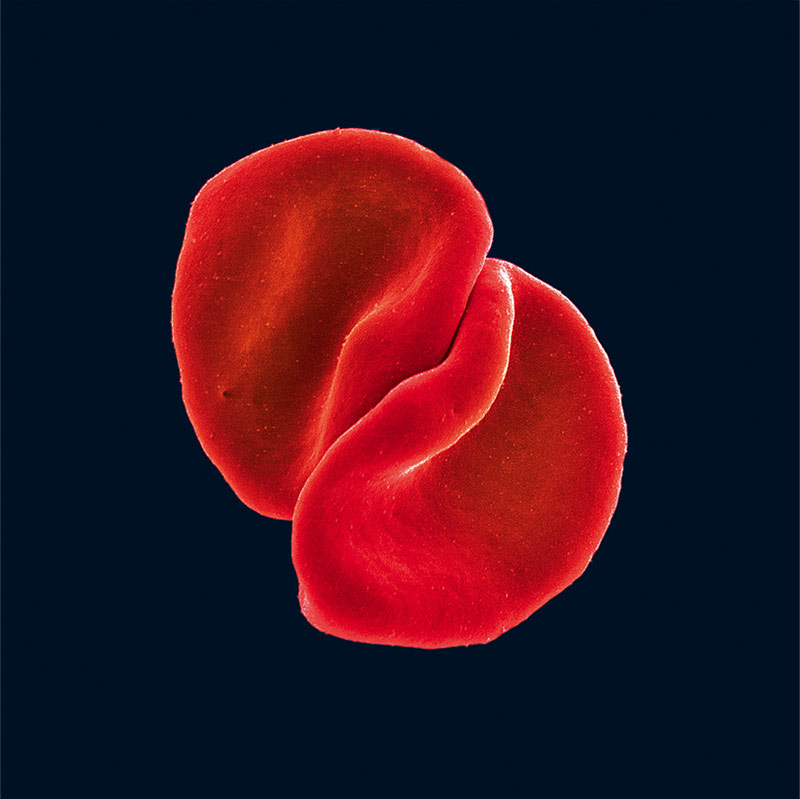 Peter Gabriel, Scratch My Back Album Cover, 2010 | San Francisco Art ...